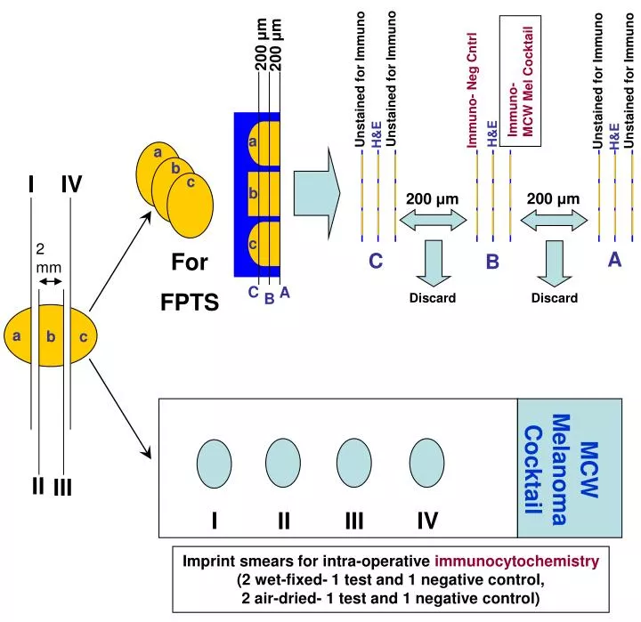 PPT - Imprint smears for intra-operative immunocytochemistry PowerPoint ...