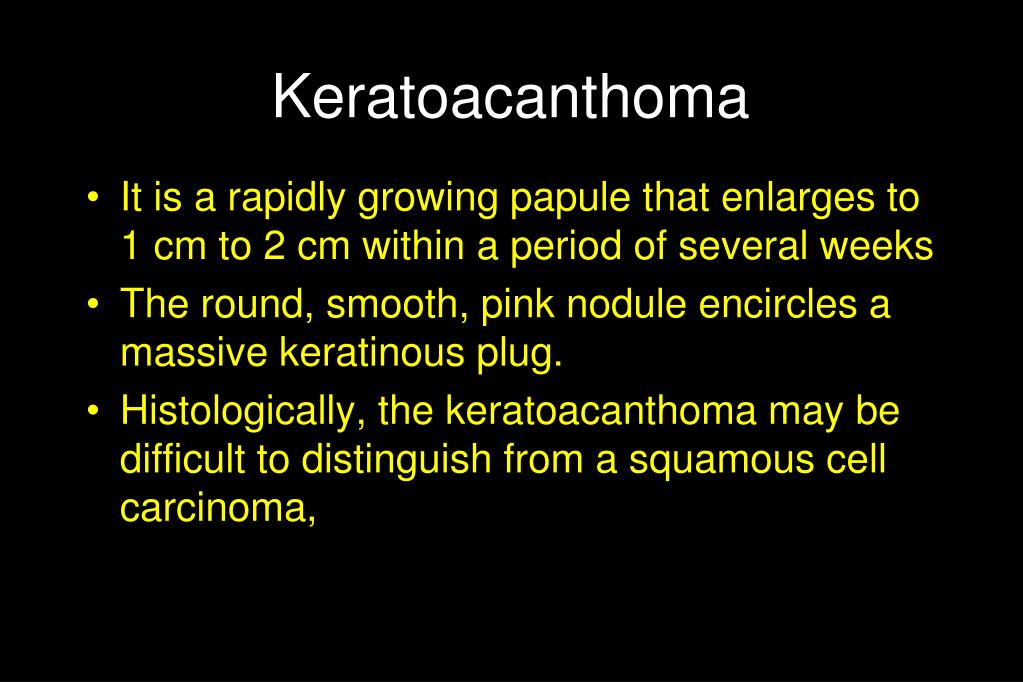 PPT - Skin Tumors and Their Treatments: PowerPoint Presentation, free ...