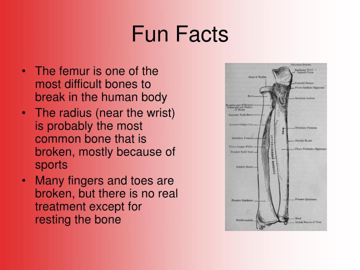 PPT - Broken Bones PowerPoint Presentation - ID:4121003