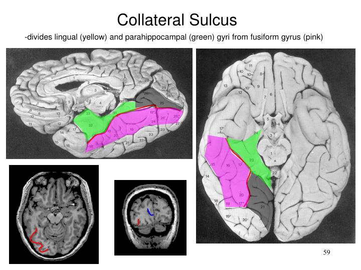 PPT - 1. Introduction to fMRI PowerPoint Presentation - ID:4121346