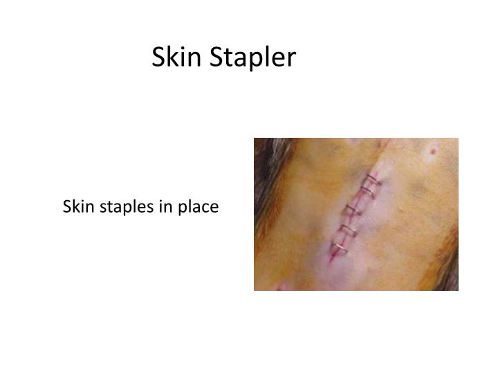 PPT - Suture, Needles, Staplers, Wound Closure Techniques, & Wound ...