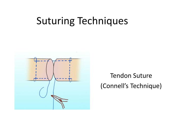 PPT - Suture, Needles, Staplers, Wound Closure Techniques, & Wound ...