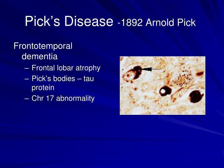 PPT - DEMENTIA PowerPoint Presentation - ID:4126830