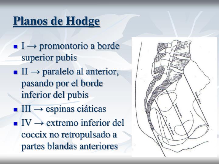 Planos De Hodge
