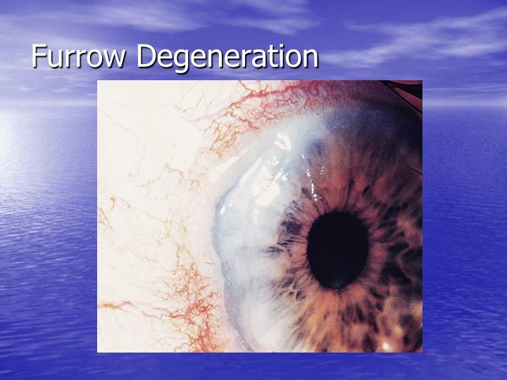 PPT - Corneal Dystrophies and Degenerations PowerPoint Presentation ...