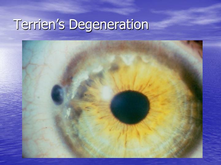 PPT - Corneal Dystrophies and Degenerations PowerPoint Presentation ...
