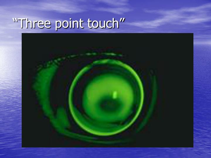 PPT - Corneal Dystrophies and Degenerations PowerPoint Presentation ...