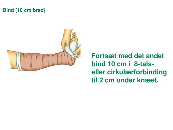 PPT - Anlæggelsesvejledning kompressionsbind PowerPoint Presentation ...
