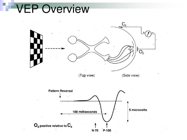 PPT - Visual Evoked Potentials PowerPoint Presentation - ID:4131735
