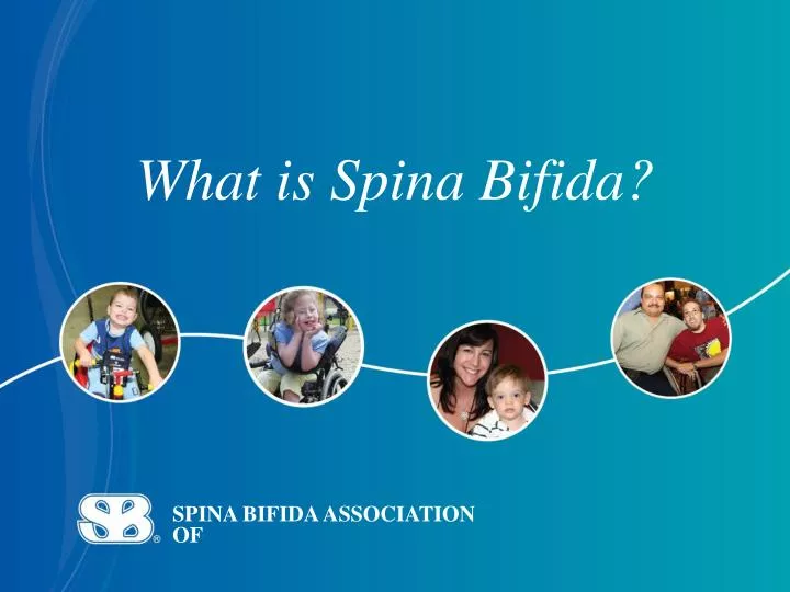 Ppt Spina Bifida Association Of Powerpoint Presentation Free