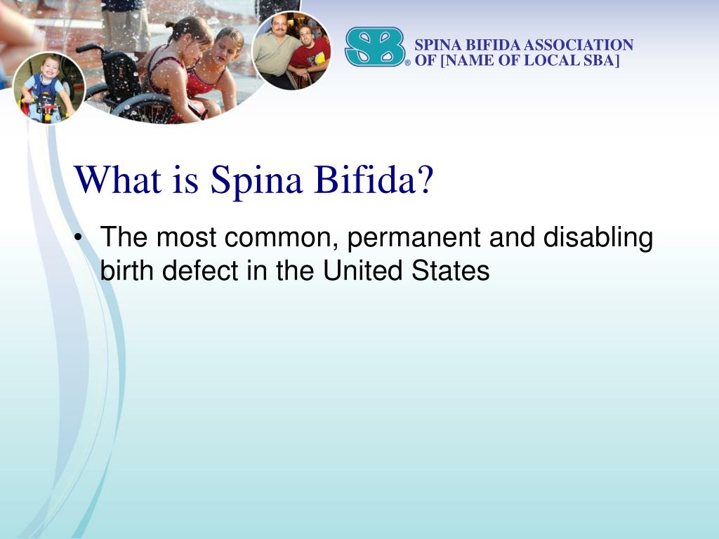 Ppt Spina Bifida Association Of Powerpoint Presentation Free