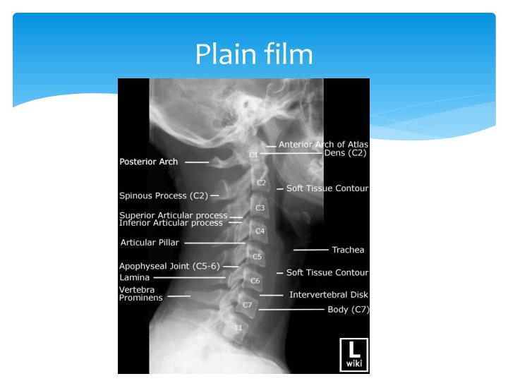 PPT - The cervical spine. Normal anatomy, variants and pathology ...