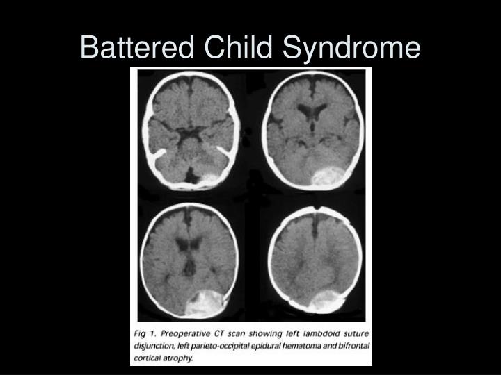PPT - Trauma PowerPoint Presentation - ID:4133840