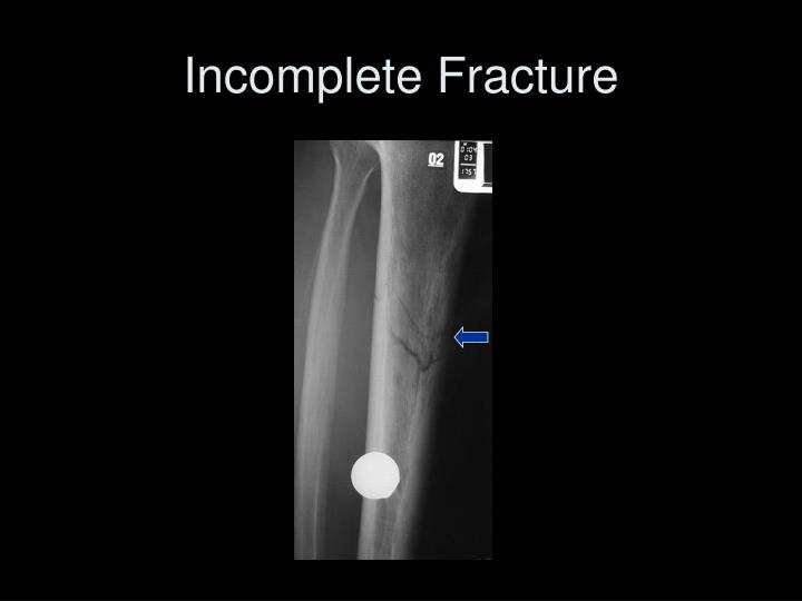 PPT - Trauma PowerPoint Presentation - ID:4133840