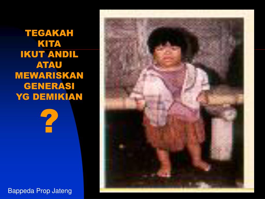 PPT - PENANGANAN GANGGUAN AKIBAT KEKURANGAN YODIUM (GAKY) PowerPoint ...