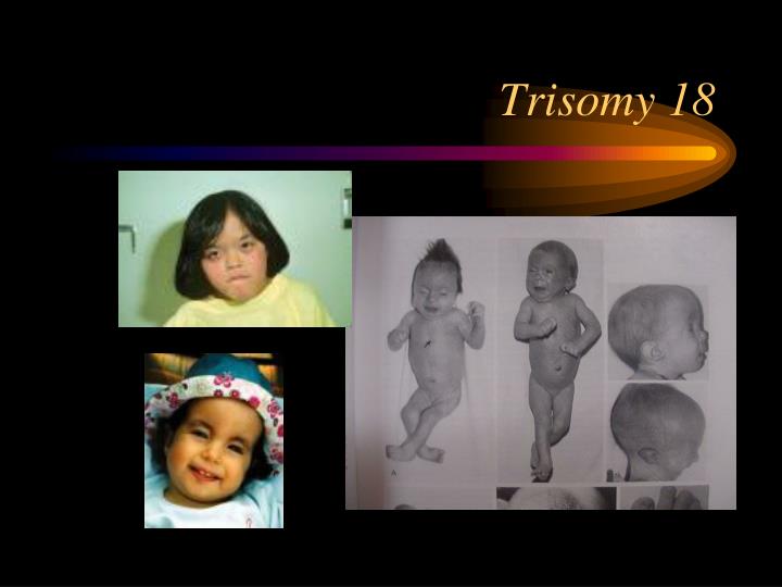 PPT - Human Genetic Disorders PowerPoint Presentation - ID:4136462