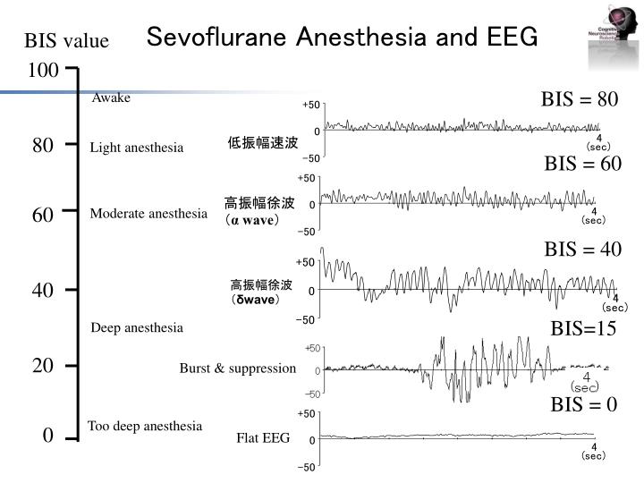 PPT - ･ General Anesthesia ・ Anesthesia and EEG ・ Mechanism of ...