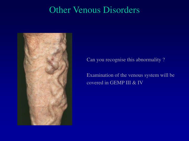PPT - VENOUS DISEASE & CHRONIC VENOUS INSUFFICIENCY PowerPoint ...