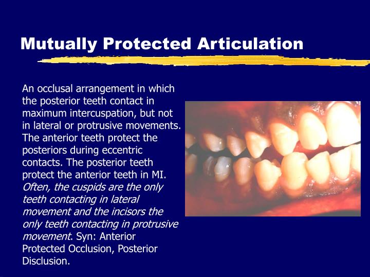 PPT - FSBGD Occlusion Review PowerPoint Presentation - ID:4145041