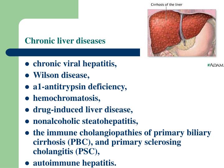 PPT - Hepatology PowerPoint Presentation - ID:4145083