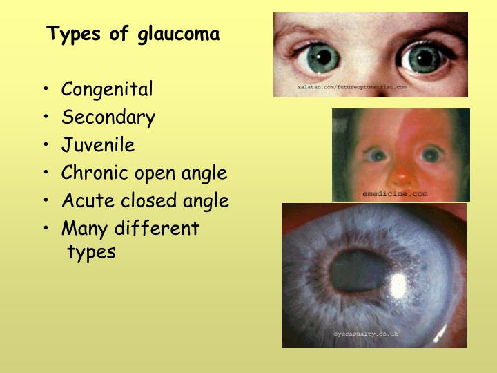 PPT - Glaucoma: what is happening PowerPoint Presentation - ID:4149024