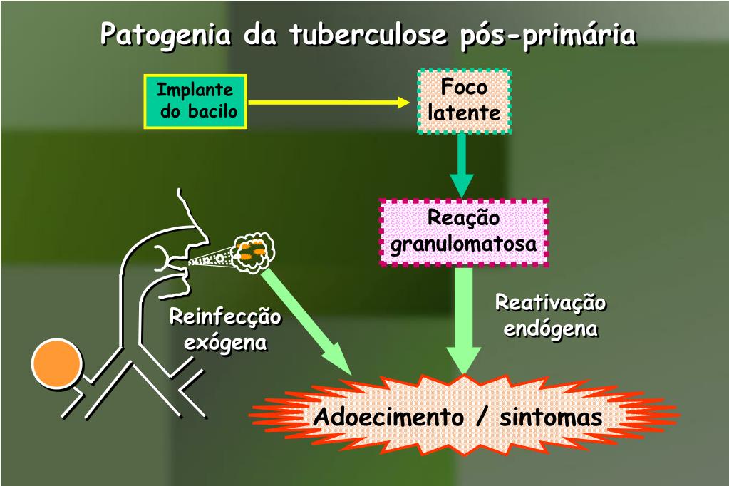 PPT - A patogenia das imagens na tuberculose pulmonar PowerPoint ...