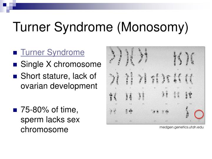 PPT - Chromosomes and Karyotyping PowerPoint Presentation - ID:4153225