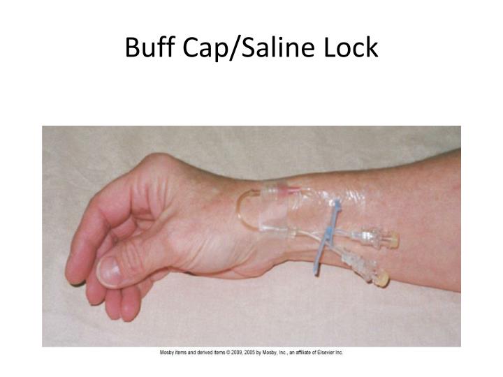 PPT - Intravenous Administration PowerPoint Presentation - ID:4154847