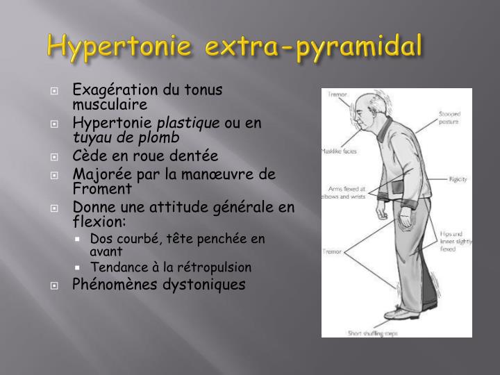 PPT - MALADIE DE PARKINSON PowerPoint Presentation - ID:4161112