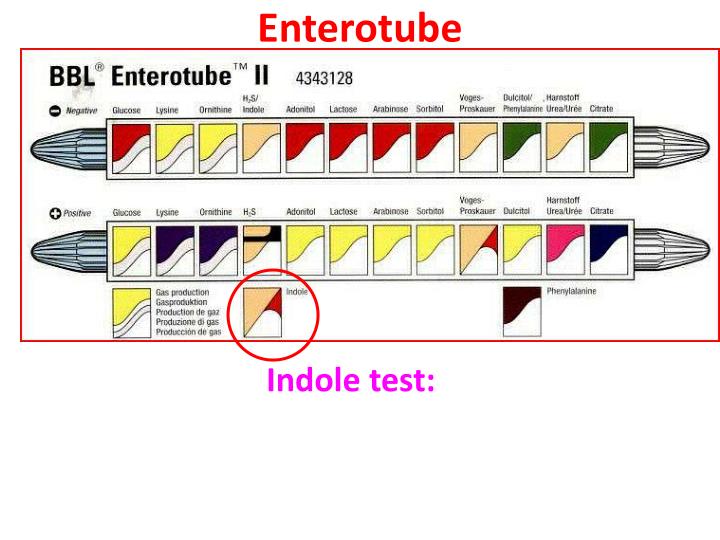 PPT - Enterotube PowerPoint Presentation - ID:4161759