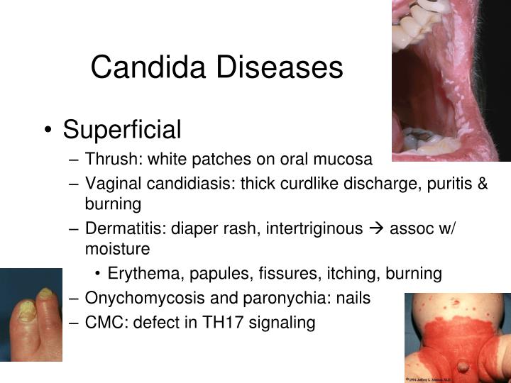PPT - Fungi for Fellows PowerPoint Presentation - ID:4163423