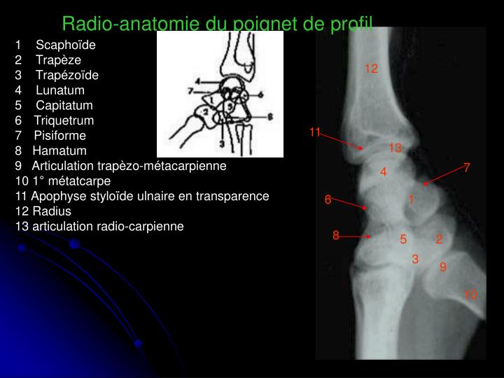 PPT - ANATOMIE RADIOLOGIQUE DU POIGNET PowerPoint Presentation - ID:4163559