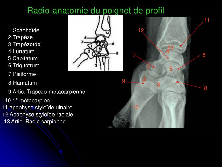 PPT - ANATOMIE RADIOLOGIQUE DU POIGNET PowerPoint Presentation - ID:4163559