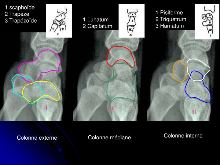 PPT - ANATOMIE RADIOLOGIQUE DU POIGNET PowerPoint Presentation - ID:4163559