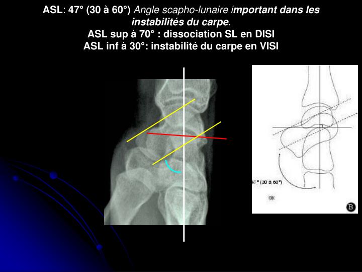 PPT - ANATOMIE RADIOLOGIQUE DU POIGNET PowerPoint Presentation - ID:4163559