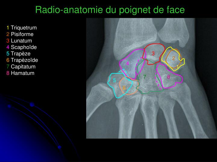 PPT - ANATOMIE RADIOLOGIQUE DU POIGNET PowerPoint Presentation - ID:4163559