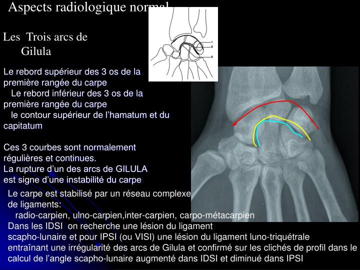 PPT - ANATOMIE RADIOLOGIQUE DU POIGNET PowerPoint Presentation - ID:4163559