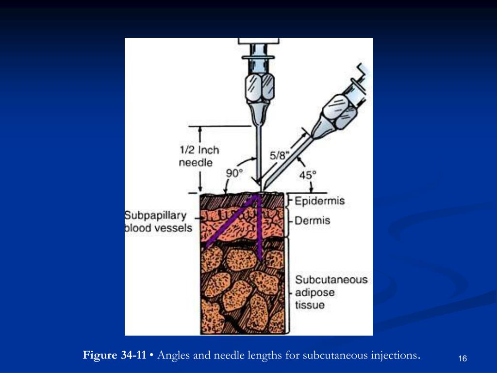 PPT - Fundamental Nursing Chapter 34 Parenteral Medications PowerPoint ...