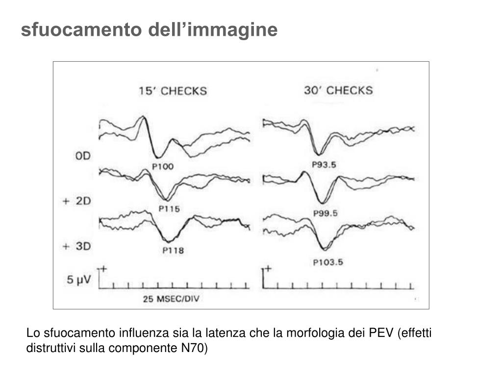 PPT - Potenziali Evocati Visivi (PEV) PowerPoint Presentation, free ...