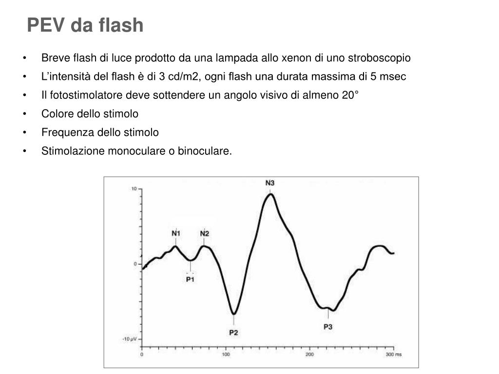 PPT - Potenziali Evocati Visivi (PEV) PowerPoint Presentation, free ...
