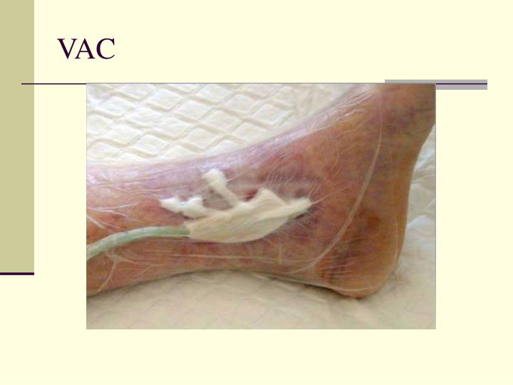 PPT - Drenajes PowerPoint Presentation - ID:4170406