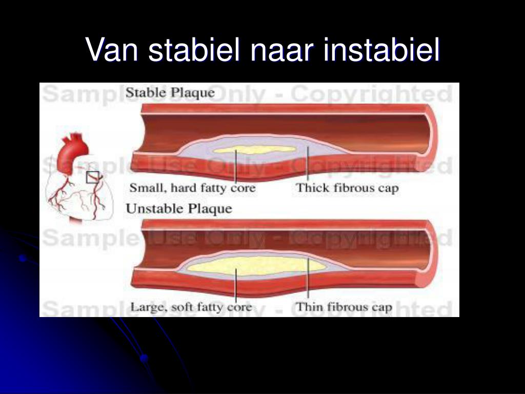 PPT - Reanimatieonderwijs als keten van overleven PowerPoint ...