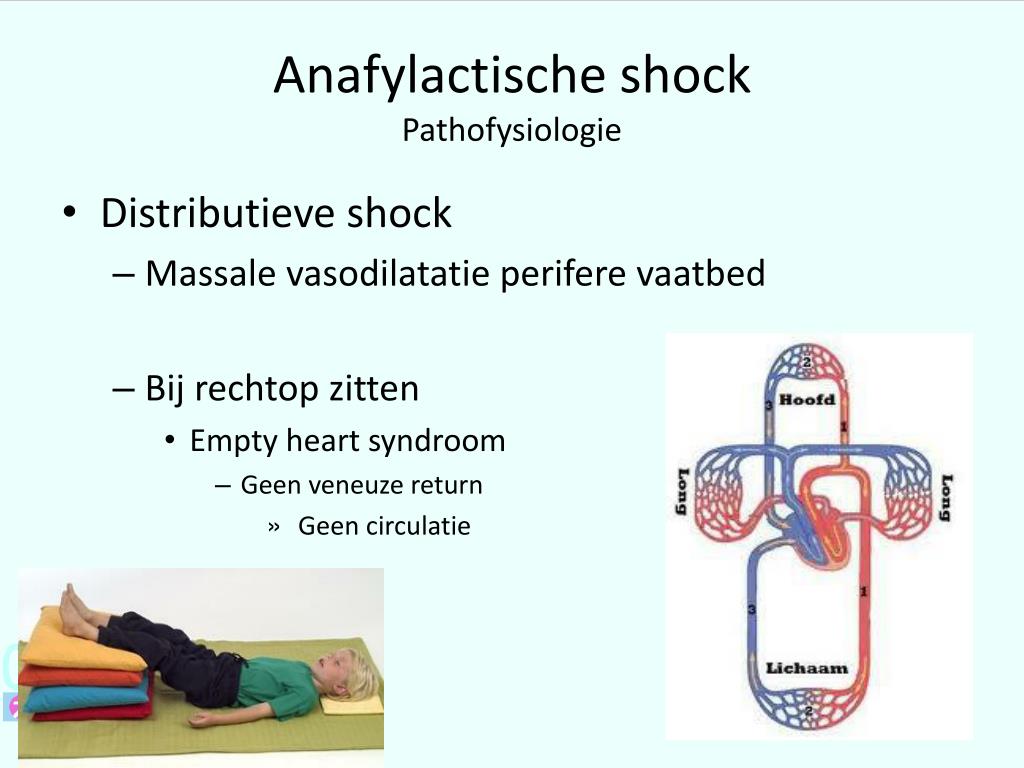 PPT - Anafylaxie en gezwollen lippen, ook adrenaline voor de huisarts ...