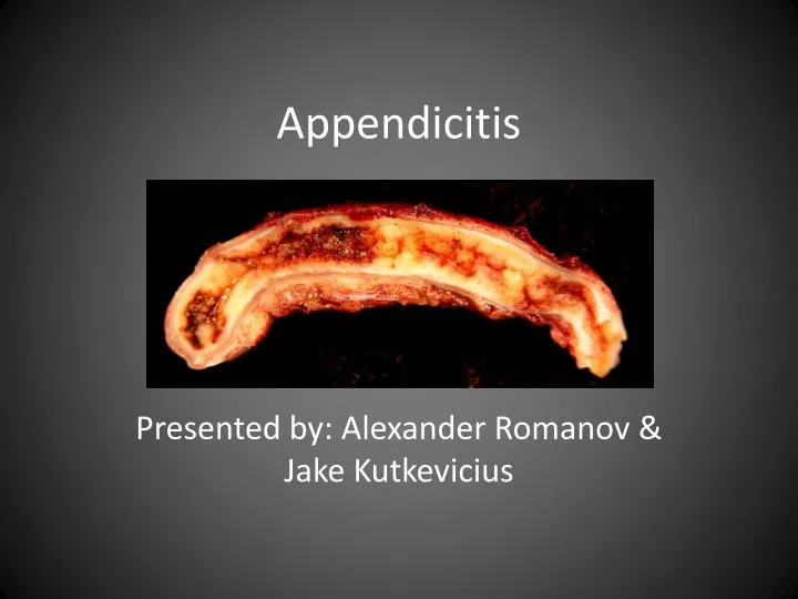 PPT - Appendicitis PowerPoint Presentation, free download - ID:4175359