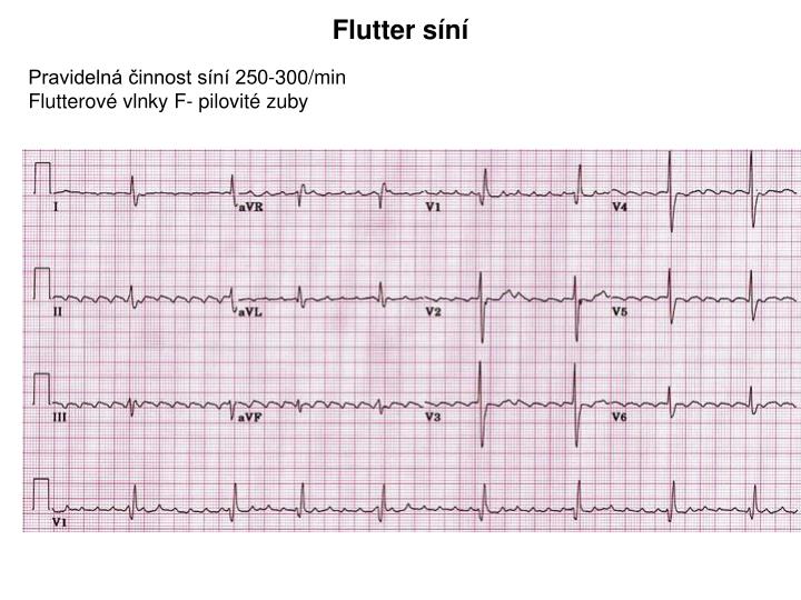 PPT - Fyziologická křivka PowerPoint Presentation - ID:4176258