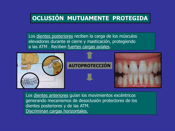 PPT - OCLUSIÓN DINÁMICA PowerPoint Presentation - ID:4184191