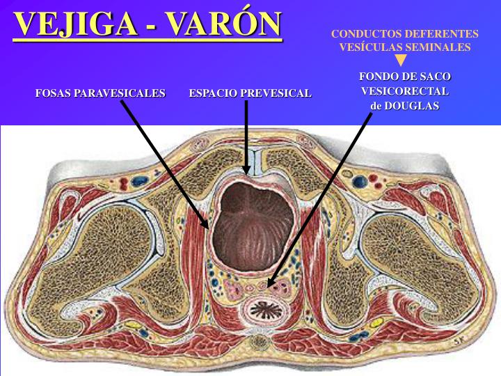 PPT - Vísceras del Abdomen ÓRGANOS RETROPERITONEALES GLÁNDULAS ...