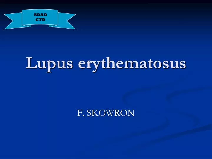 PPT - Lupus erythematosus PowerPoint Presentation, free download - ID ...