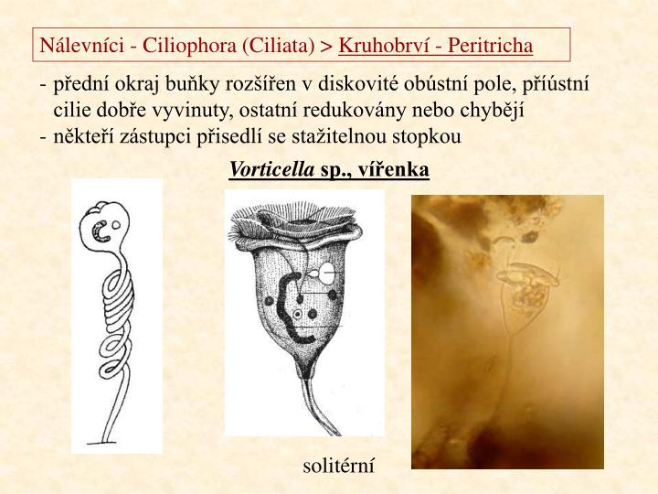 PPT - Skrytý život v akvarijním filtru PowerPoint Presentation - ID:4192654