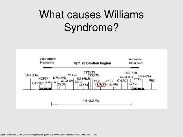 PPT - Williams Syndrome PowerPoint Presentation - ID:4195454